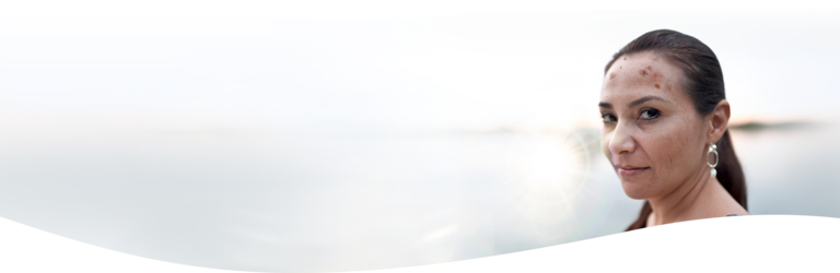 Dangers of actinic keratosis (AK) – AMELUZ® and BF-RhodoLED®