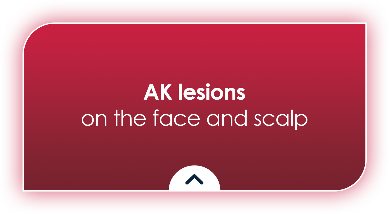 Dangers of actinic keratosis (AK) – AMELUZ® and BF-RhodoLED®